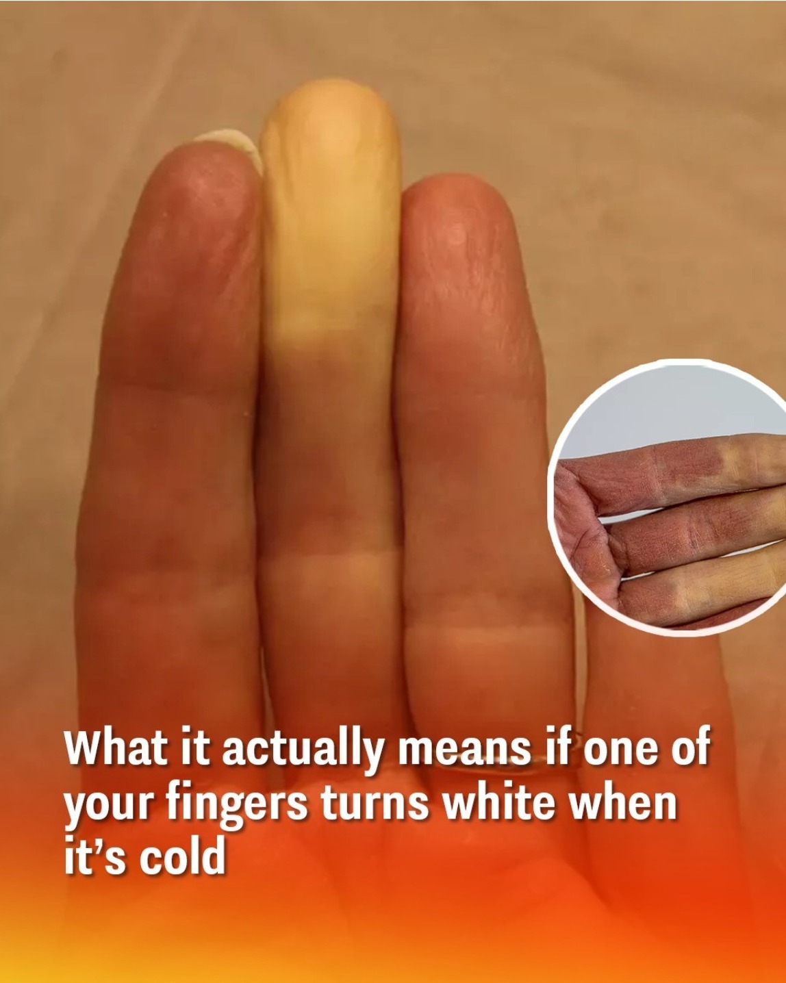 What it actually means if one of your fingers turns white when it’s ...