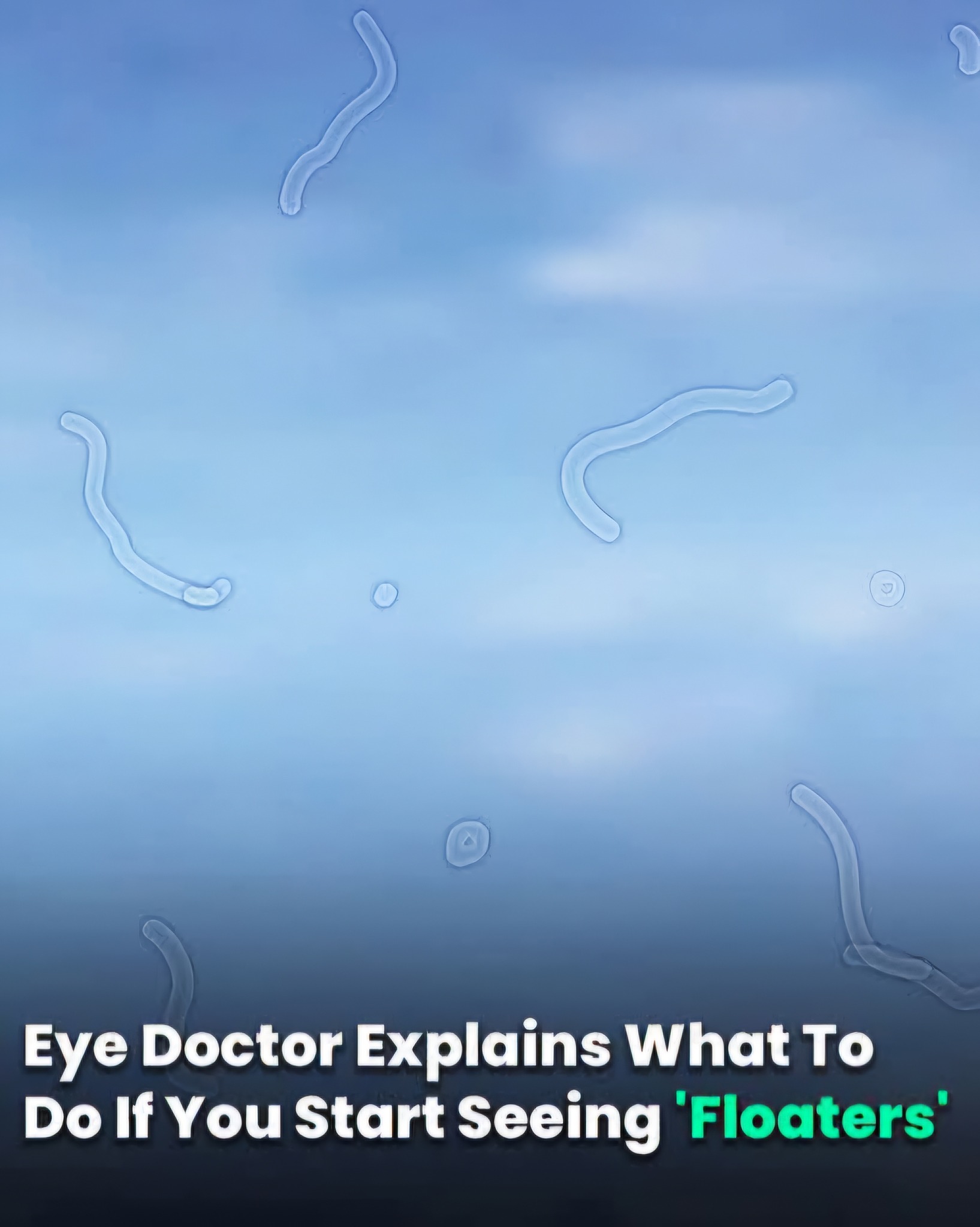 What Are Eye Floaters? Here What To Do If you Start Seeing Them ...