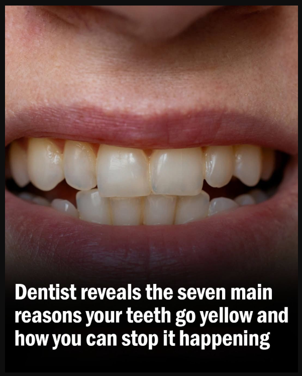 Dentist Explains 7 Key Causes of Yellowing Teeth and How to Prevent It ...