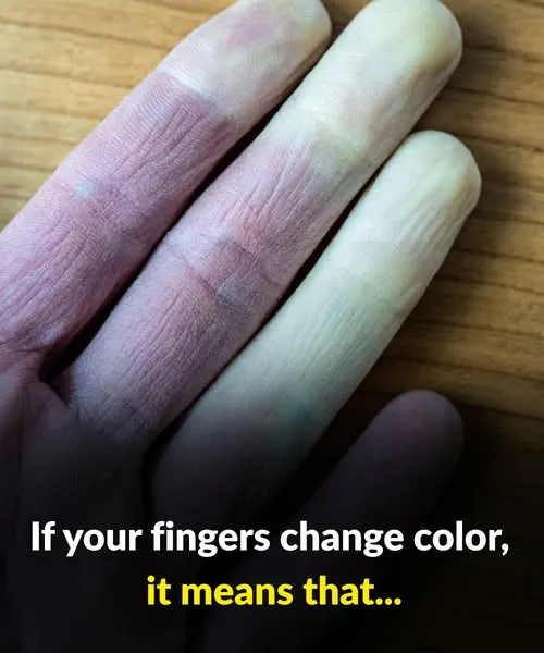 Why do fingers change color? - Usa Press