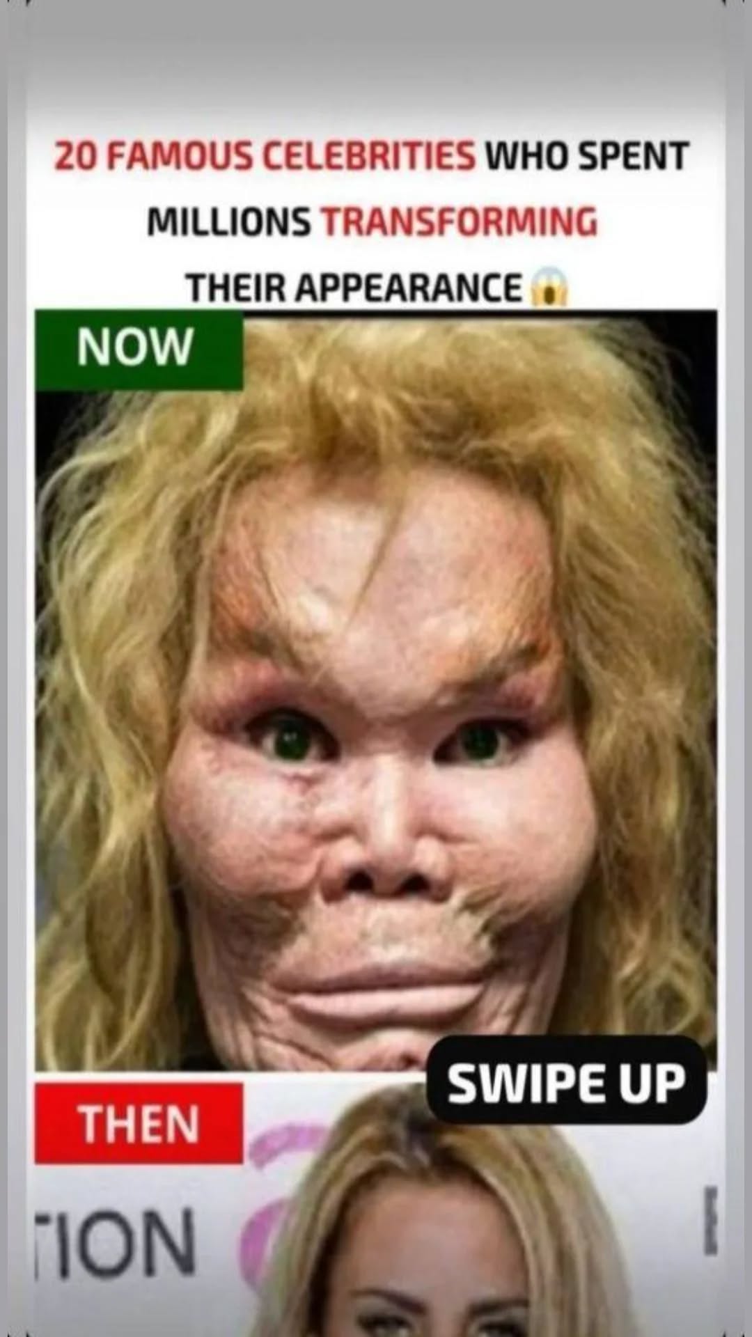 Well-known Stars Who Spent Millions Changing Their Looks - Usa Press