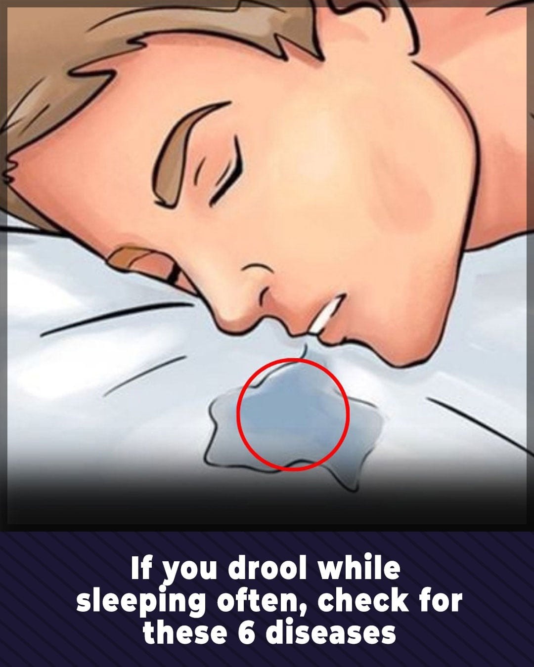 If You Drool While Sleeping Often, Check for These 6… - Usa Press