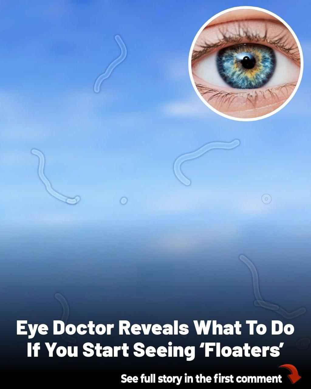 Eye Floaters: What They Are and How to Handle Them - Usa Press